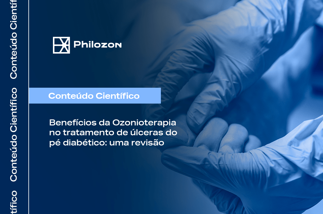 Ozonioterapia no tratamento de úlceras do pé diabético - Philozon