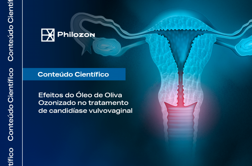 Efeitos do Óleo de Oliva Ozonizado no tratamento de candidíase - Philozon
