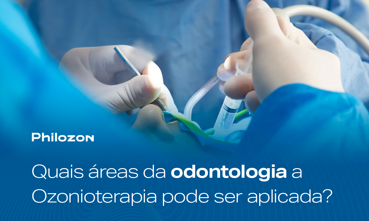 Quais áreas da Odontologia a Ozonioterapia pode ser aplicada? - Philozon