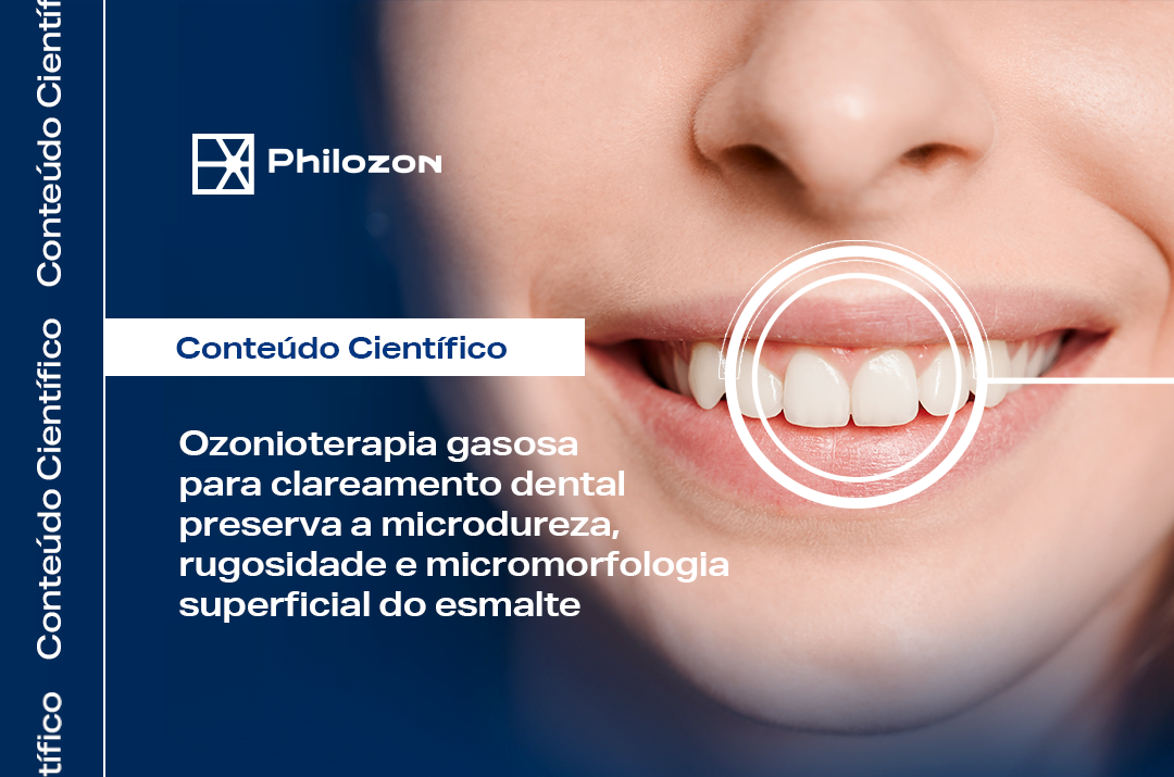 Ozonioterapia gasosa para clareamento dental - Philozon